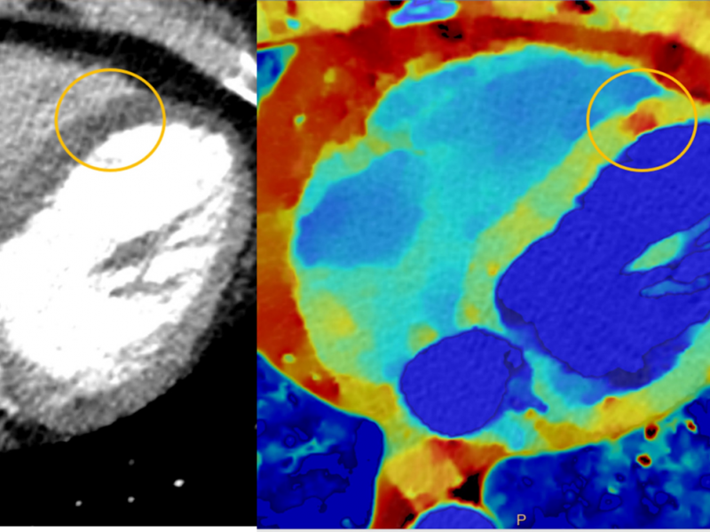 Schneller, schonender, kontrastreicher: Neuer Computertomograph am ...
