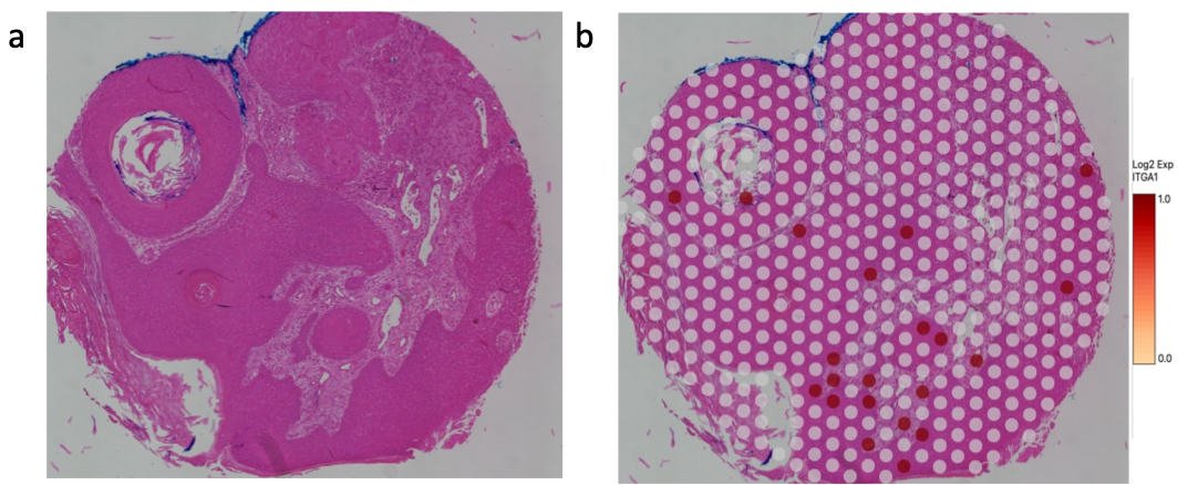 Hautflora als Schlüssel in der Krebstherapie?
