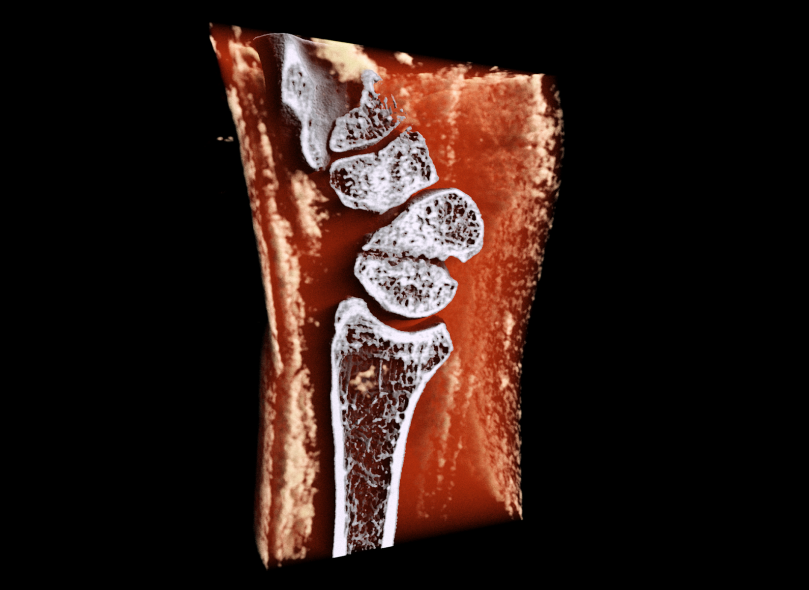 MARS’s Spectral Imaging Photon Counting Point-of-Care CT Scanner System