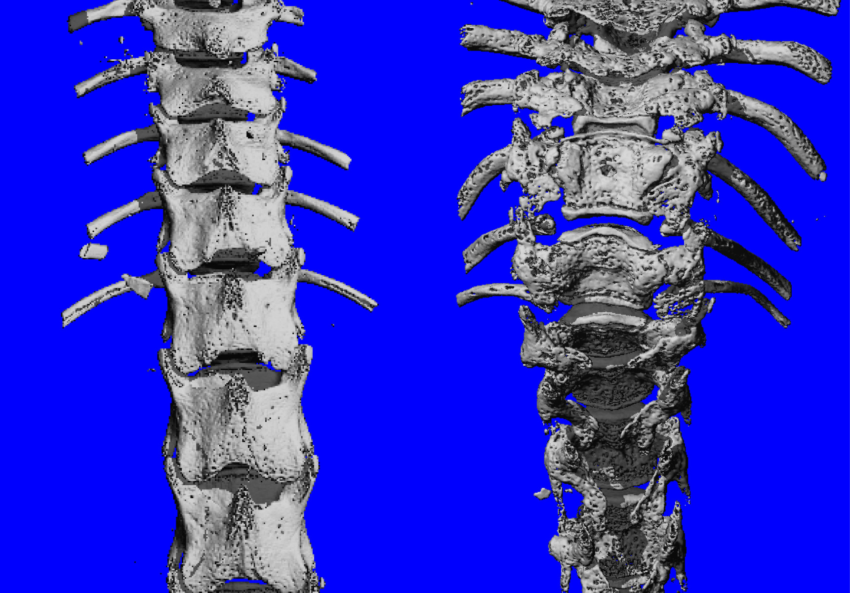 Study Published in Nature Reveals Discovery of Unique Vertebral Stem ...