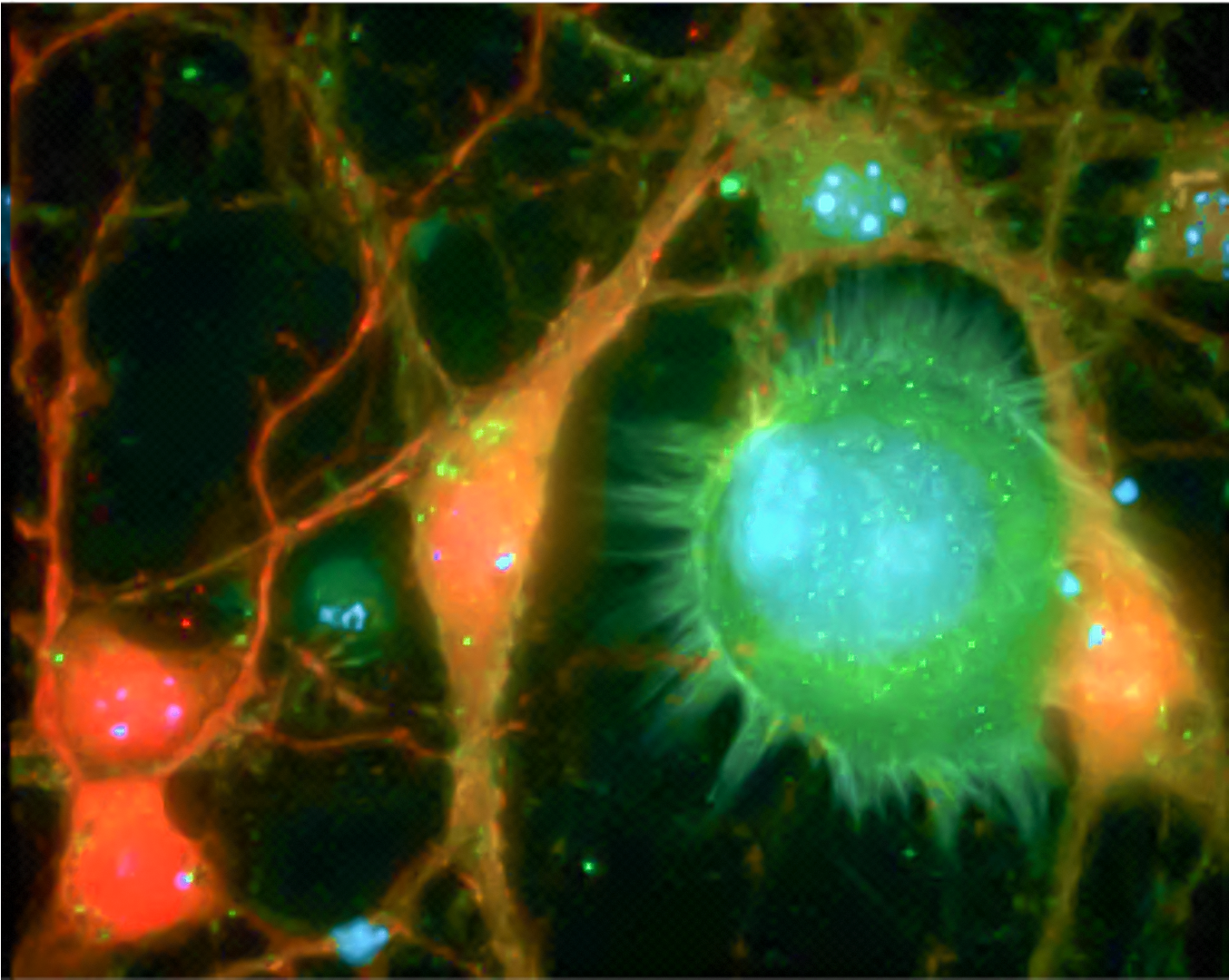 New study shows that different types of cancers are likely to spread to ...