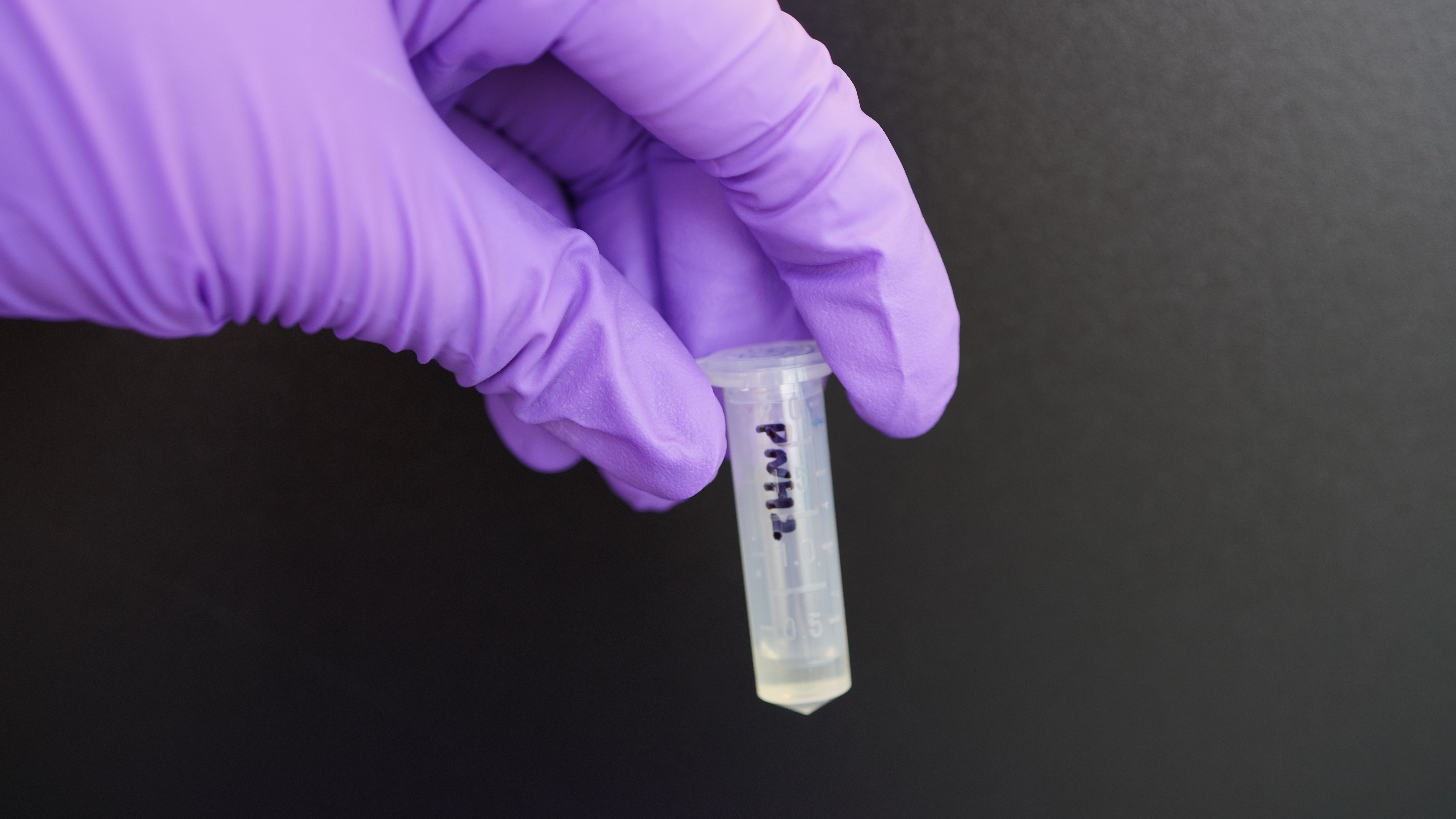 Breakthrough antibiotic shows promise against obstinate mycobacterial ...