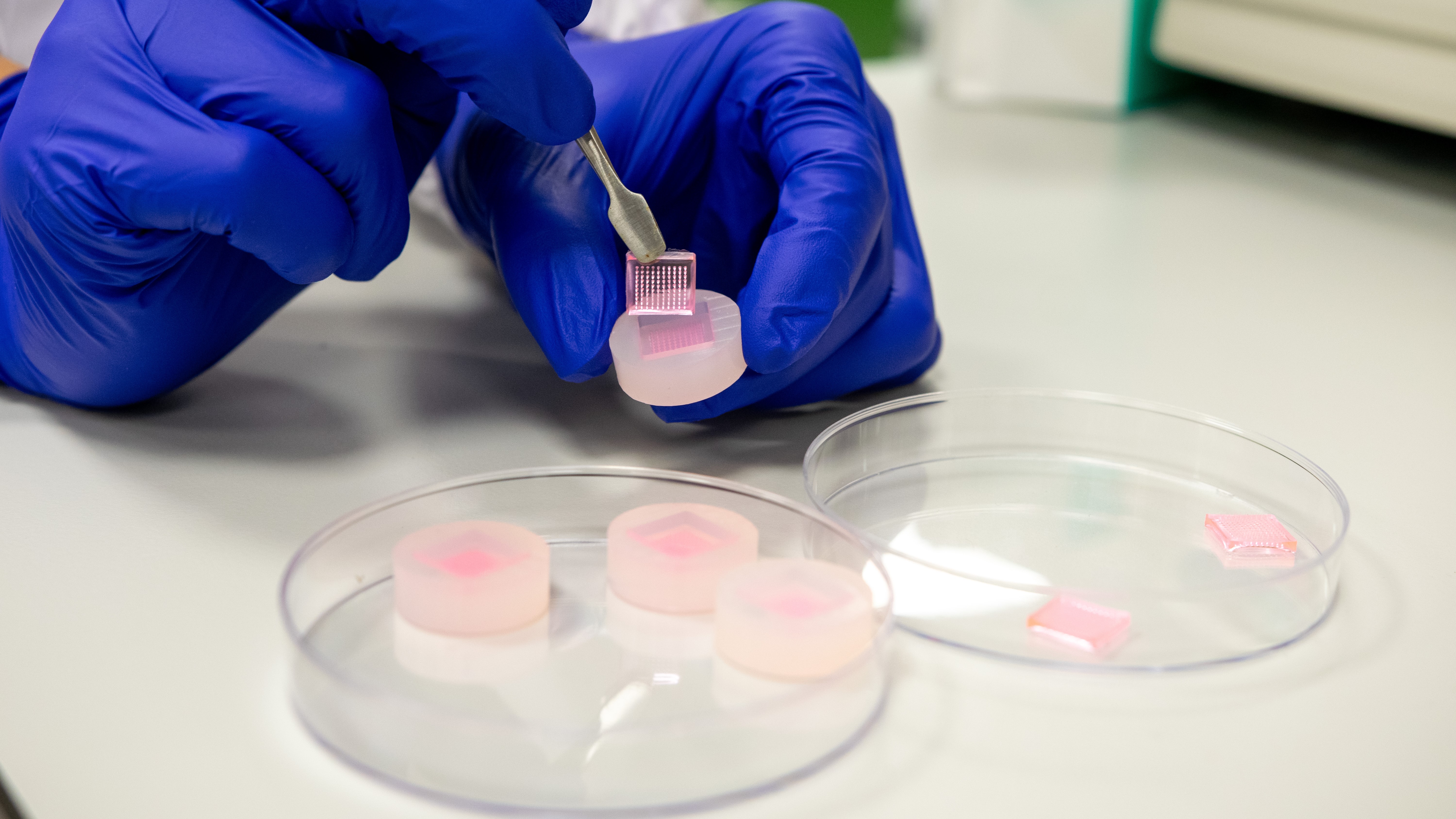 NUS researchers develop microneedle technology to accelerate diabetic ...