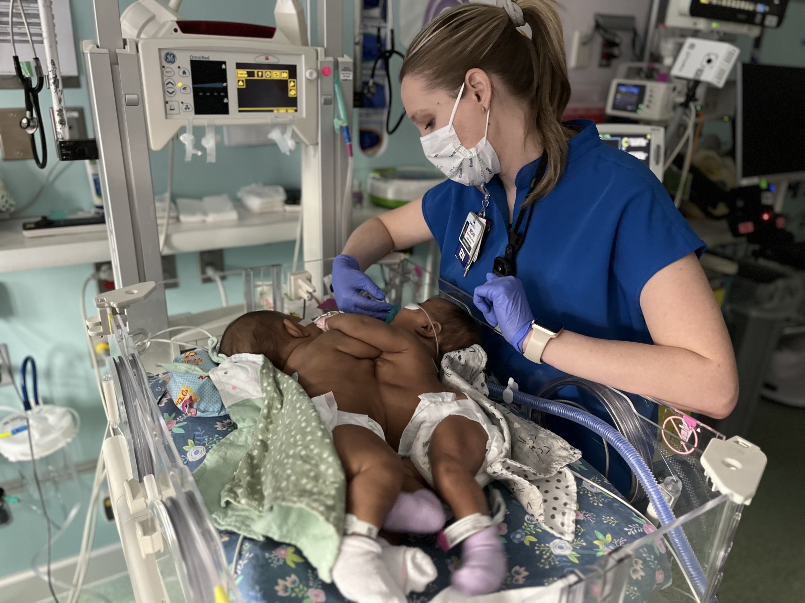 NICU Nurses Adapt for Unique Needs of Conjoined Twins