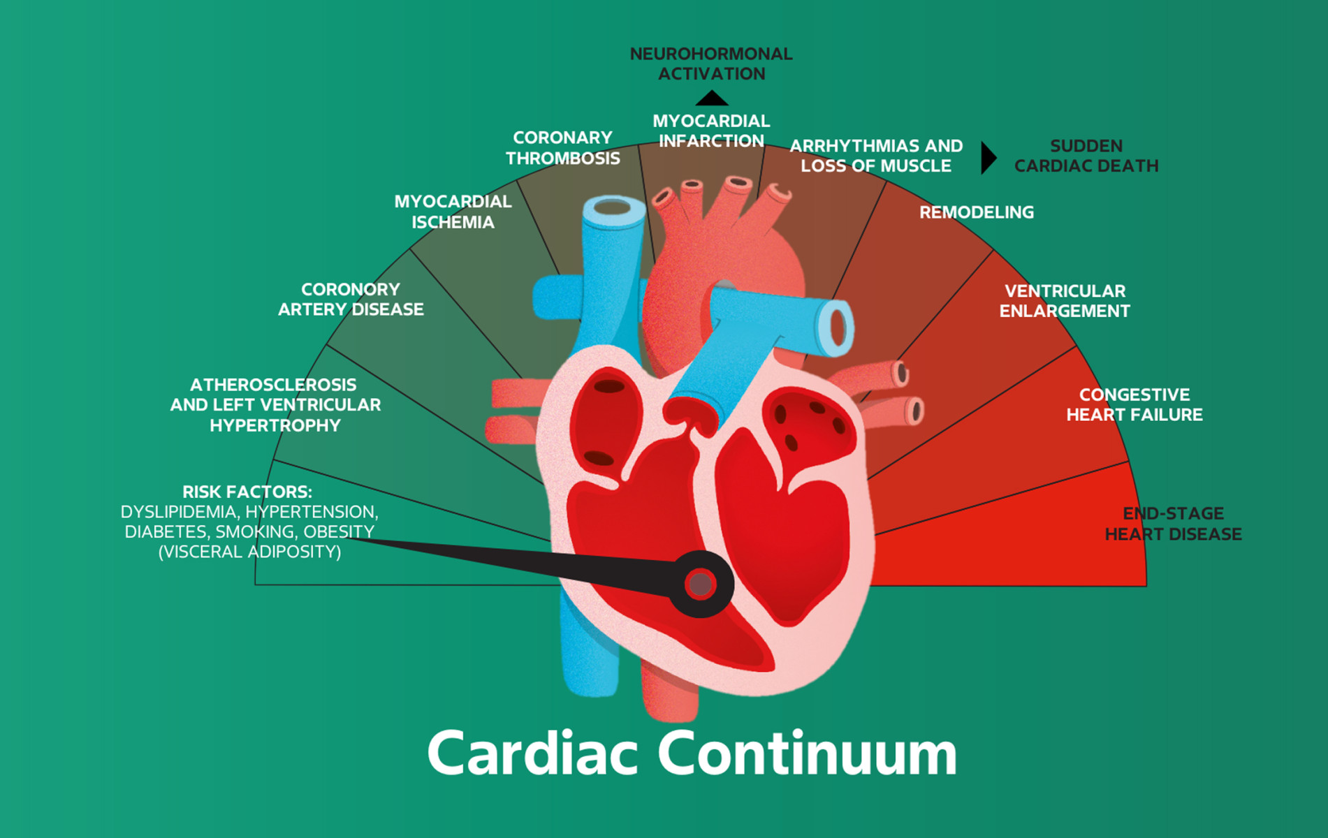 New Research Highlights the Role of Aspirin and Advanced Ultrasound ...