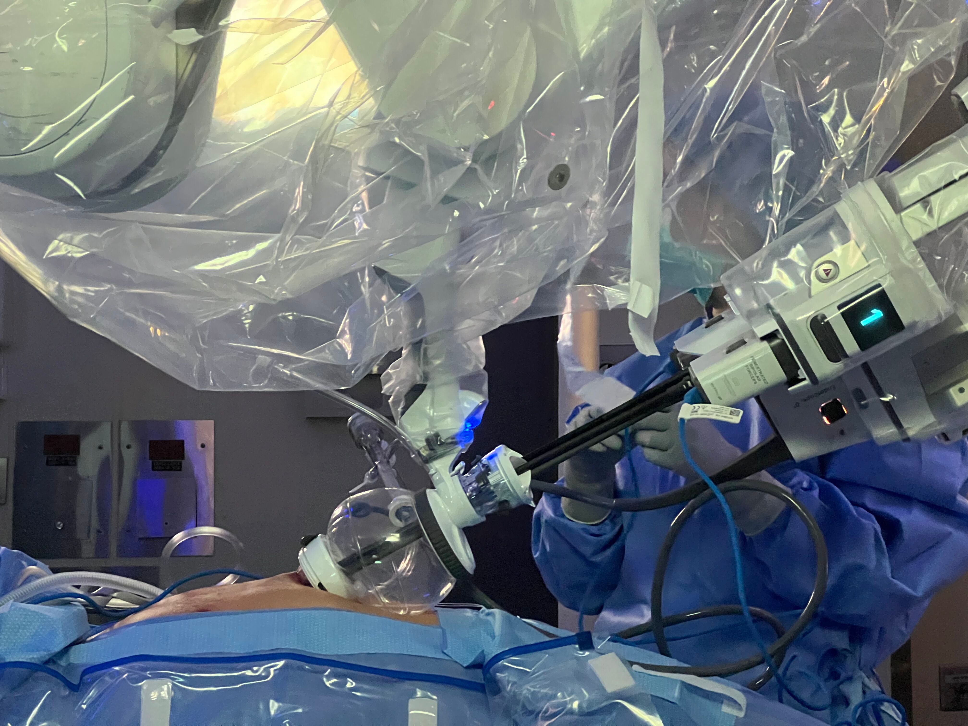 Northwestern Medicine becomes first health system in Illinois to perform single incision robotic ...
