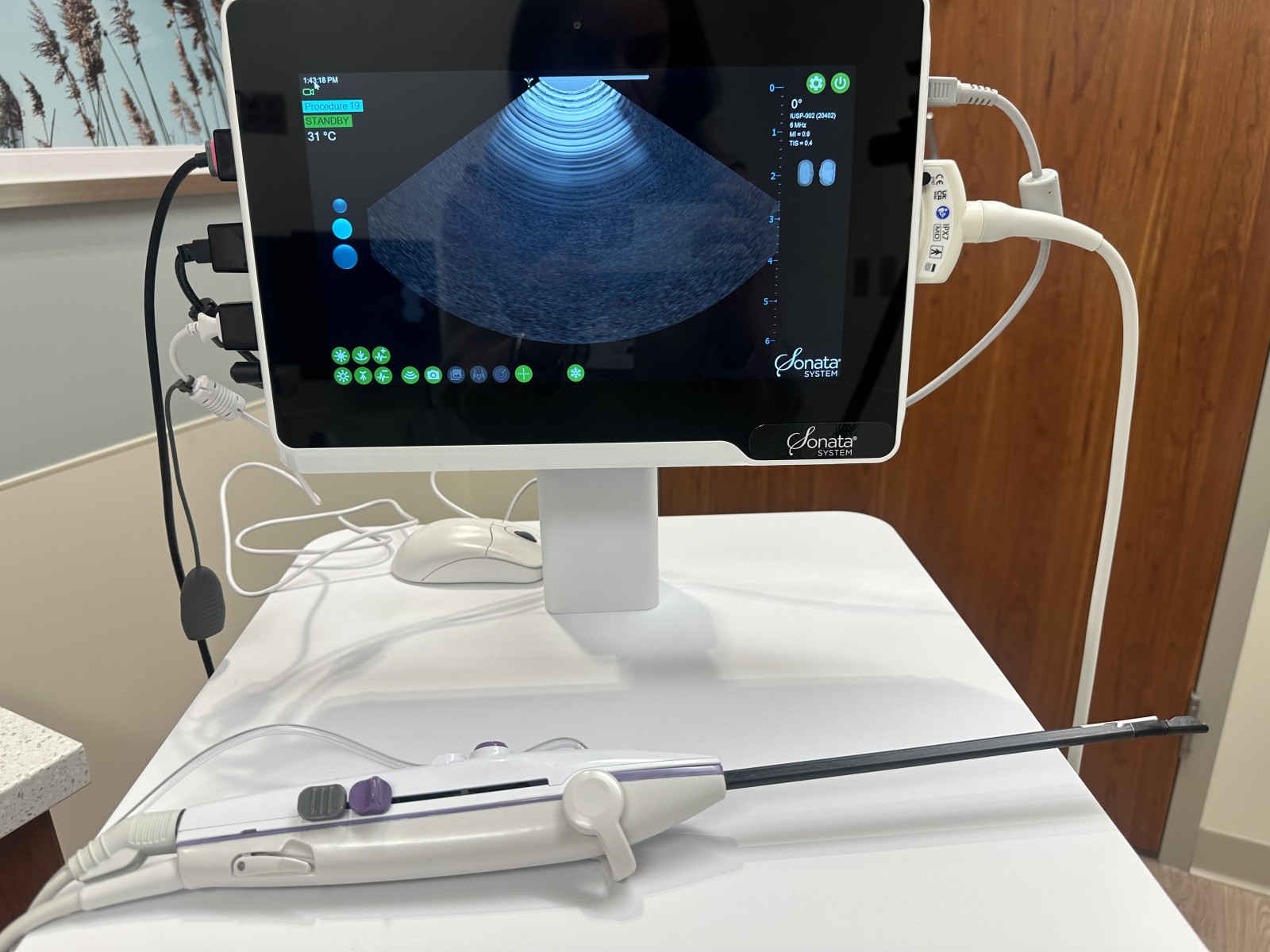 Minimally invasive TFA procedure provides relief from uterine fibroids