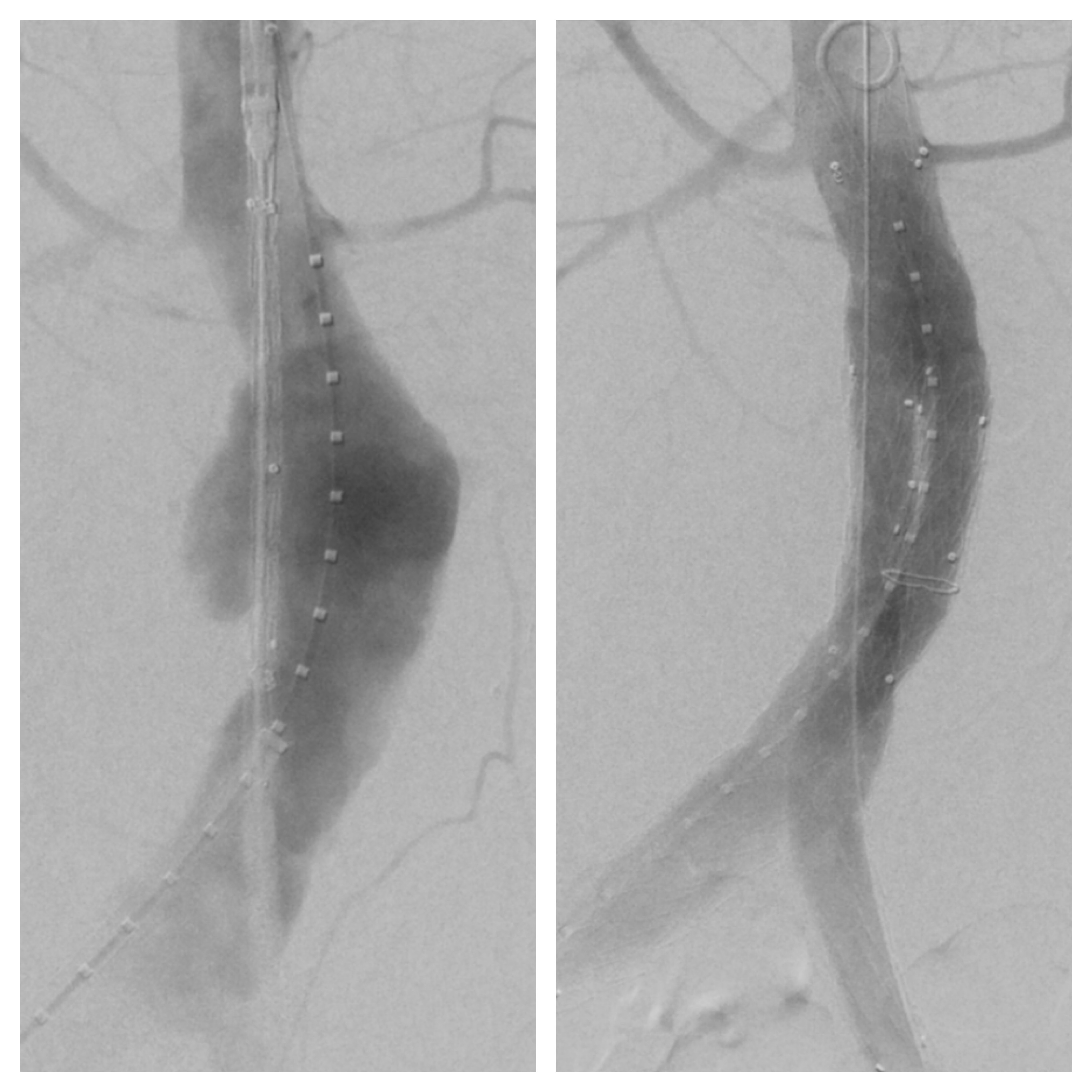 A bulge in the belly can be a silent killer: But can be treated if ...