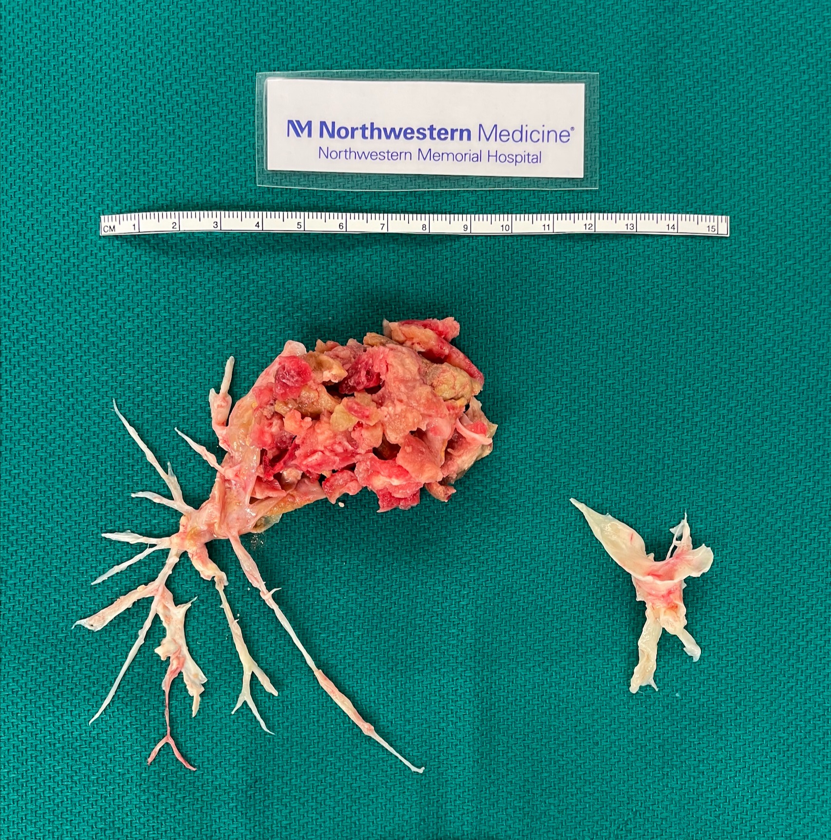 Northwestern Medicine doctors rescue former Orlando Roller Derby player ...