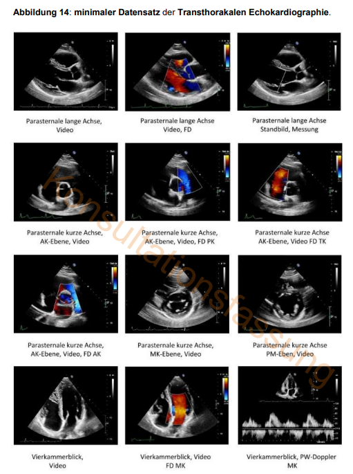 Neue AWMF-Leitlinie zur transthorakalen Echokardiographie