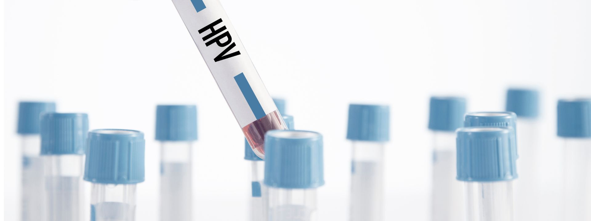 Impfung gegen Gebärmutterhalskrebs