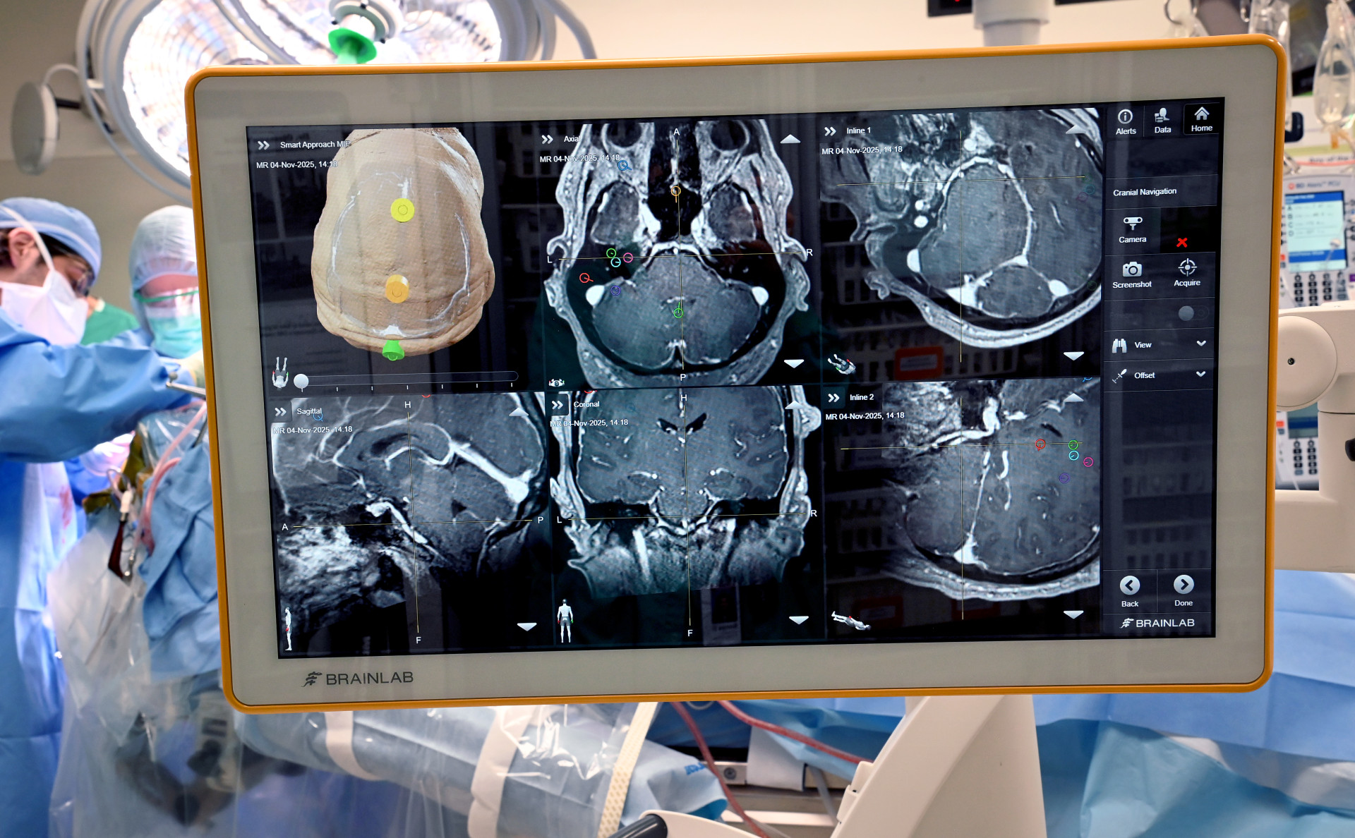 Colorado’s first implanted brain computer interface surgery marks a new ...
